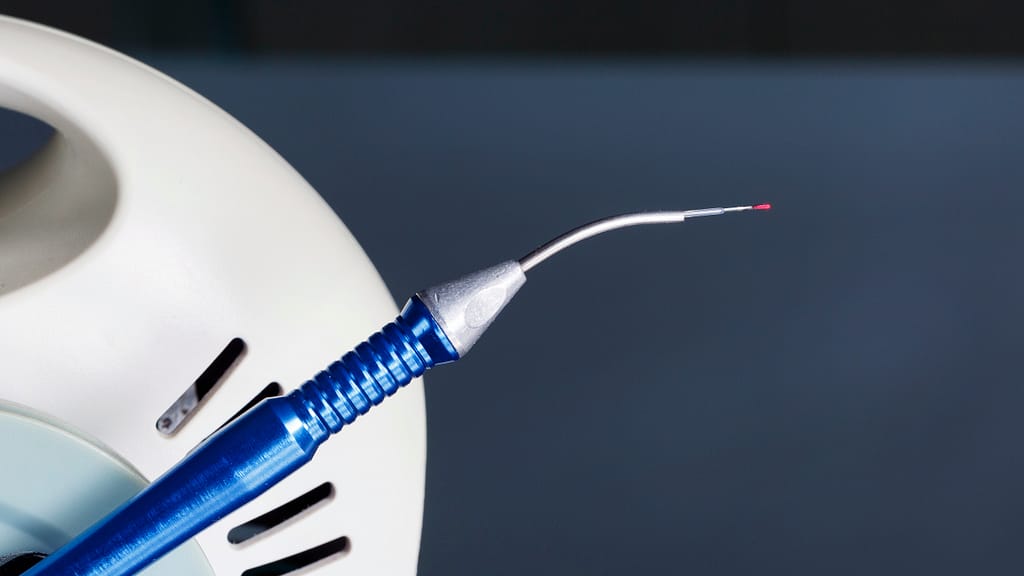 Laser Cavity Removal: How Effective Is It? | Wayzata Dental