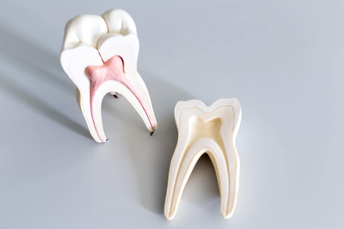 How Much Does Root Canal Cost In 2025?