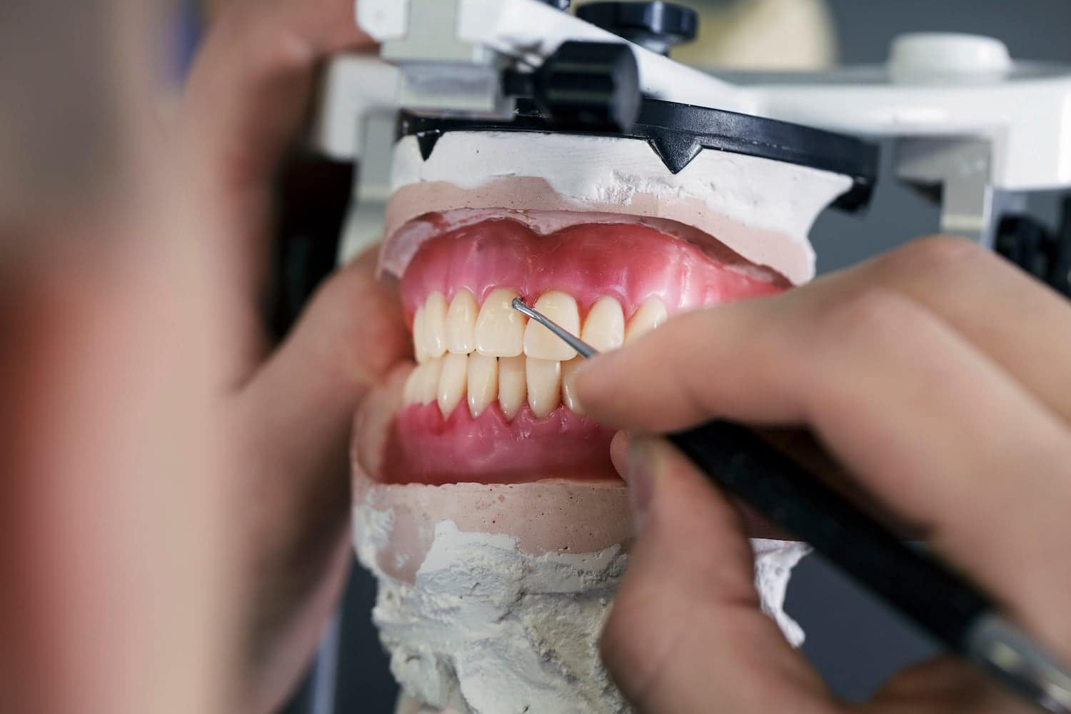 10 Signs You Need A Denture Adjustment or Repair